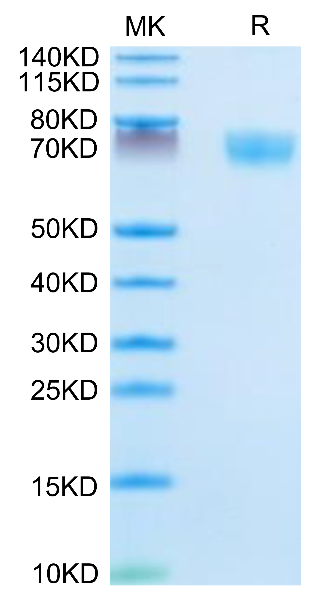 Mouse Complement Factor D/CFD Protein, Ultra Low Endotoxin (CFD-MM201-UL) | KACTUS