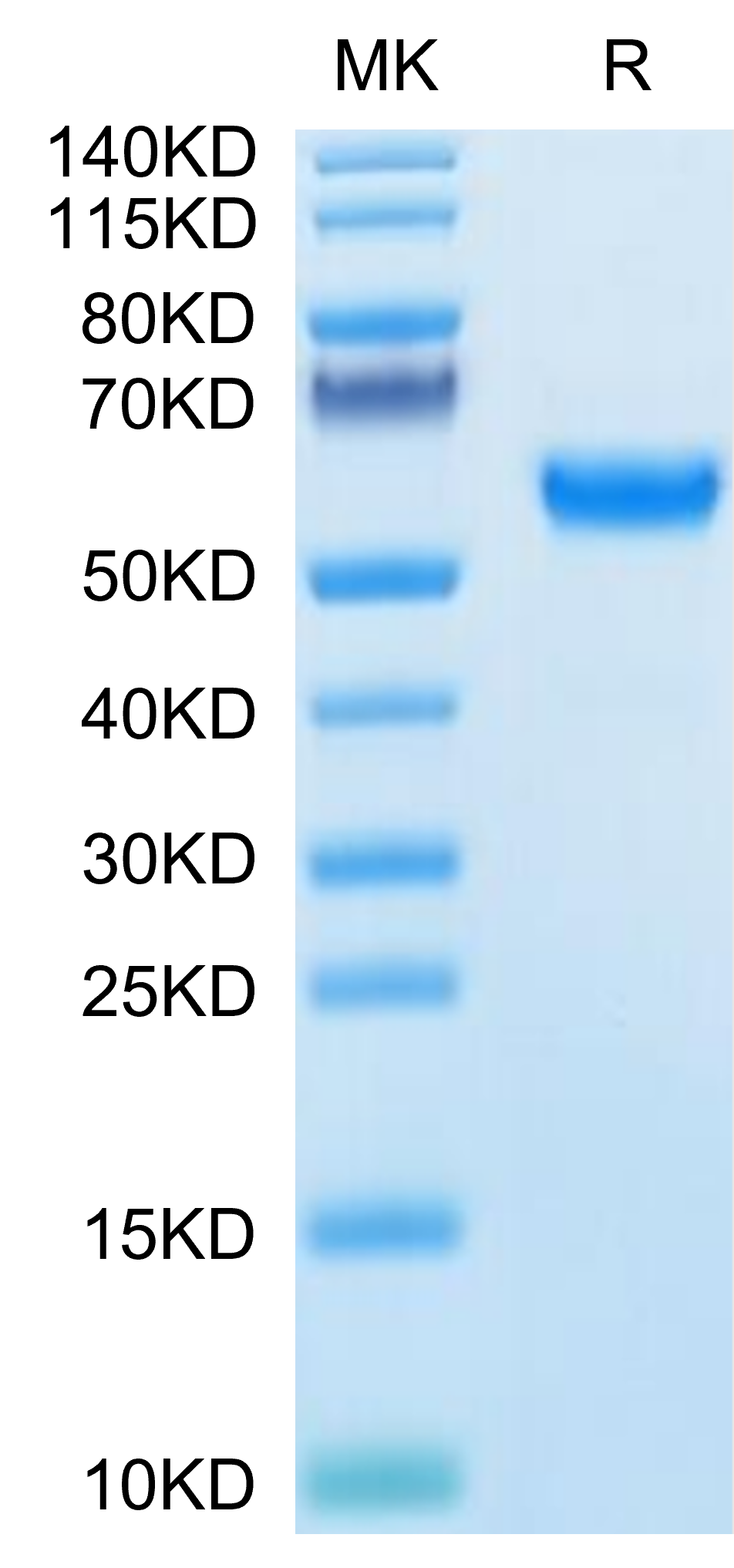 Human SPP1/OPN Protein, Ultra Low Endotoxin (SPP-HM101-UL) | KACTUS