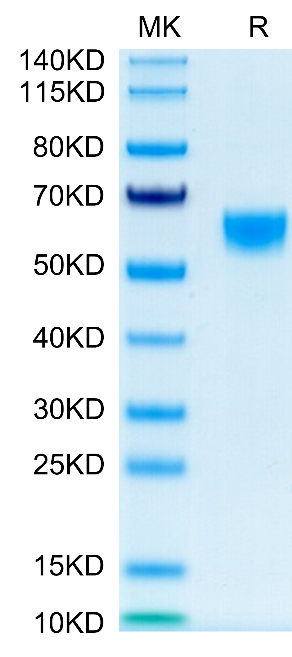 Mouse IL-9-Protein, Ultra Low Endotoxin (IL9-MM201-UL) | KACTUS