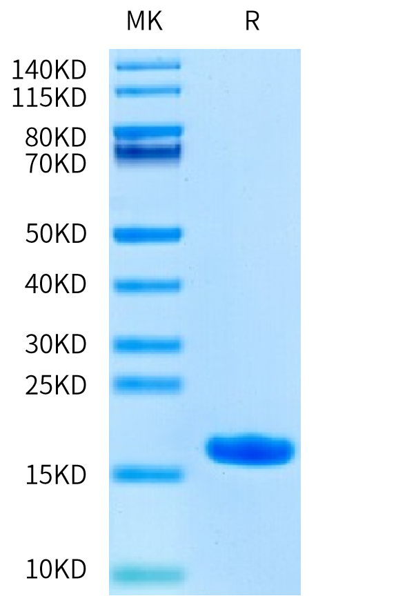 GMP Human IL-21 (GMP-CKS-HE021) | KACTUS