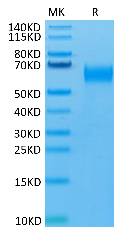 Non-biotinylated Human SIRP Beta 1 isoform 3 Protein, Ultra Low ...