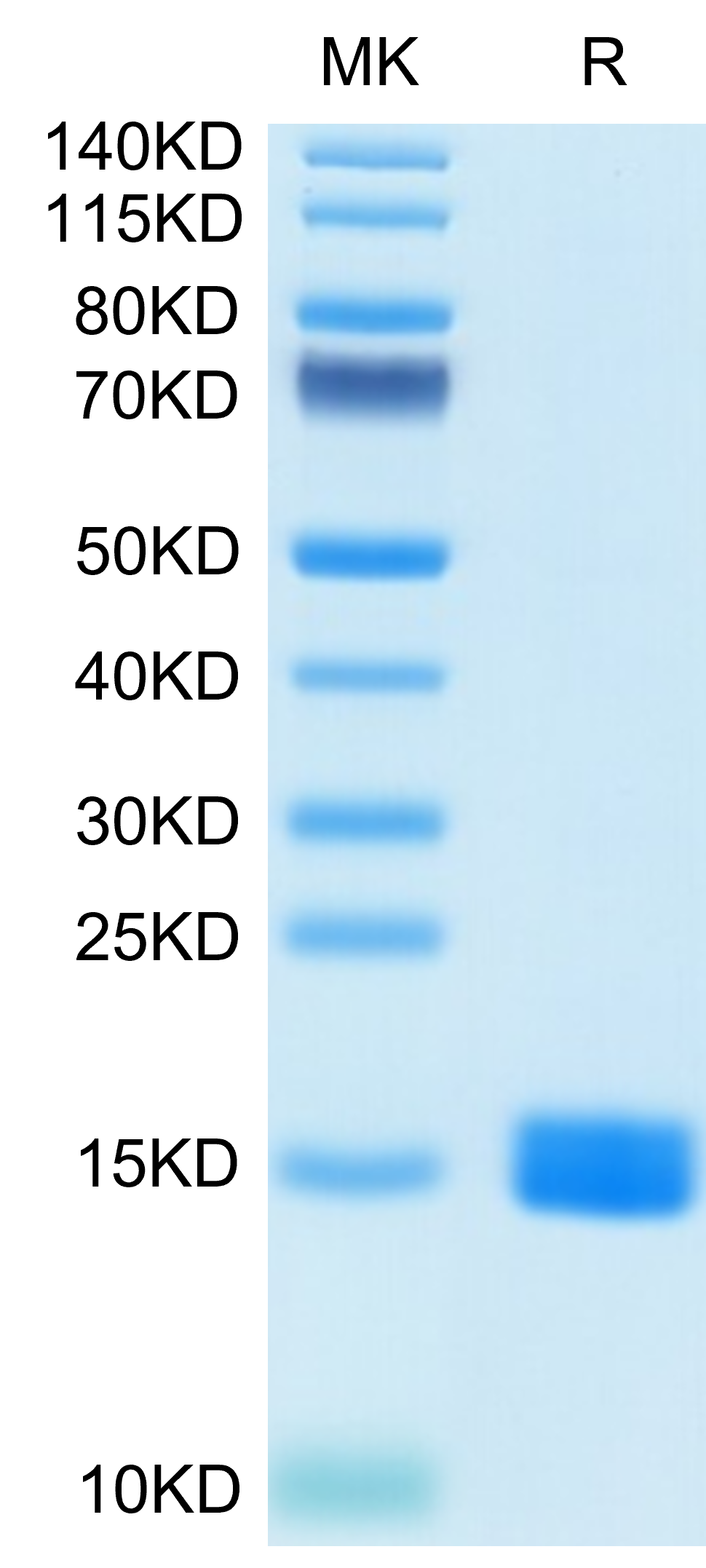 Human MARCO Protein, Ultra Low Endotoxin (MRO-HM102-UL) | KACTUS