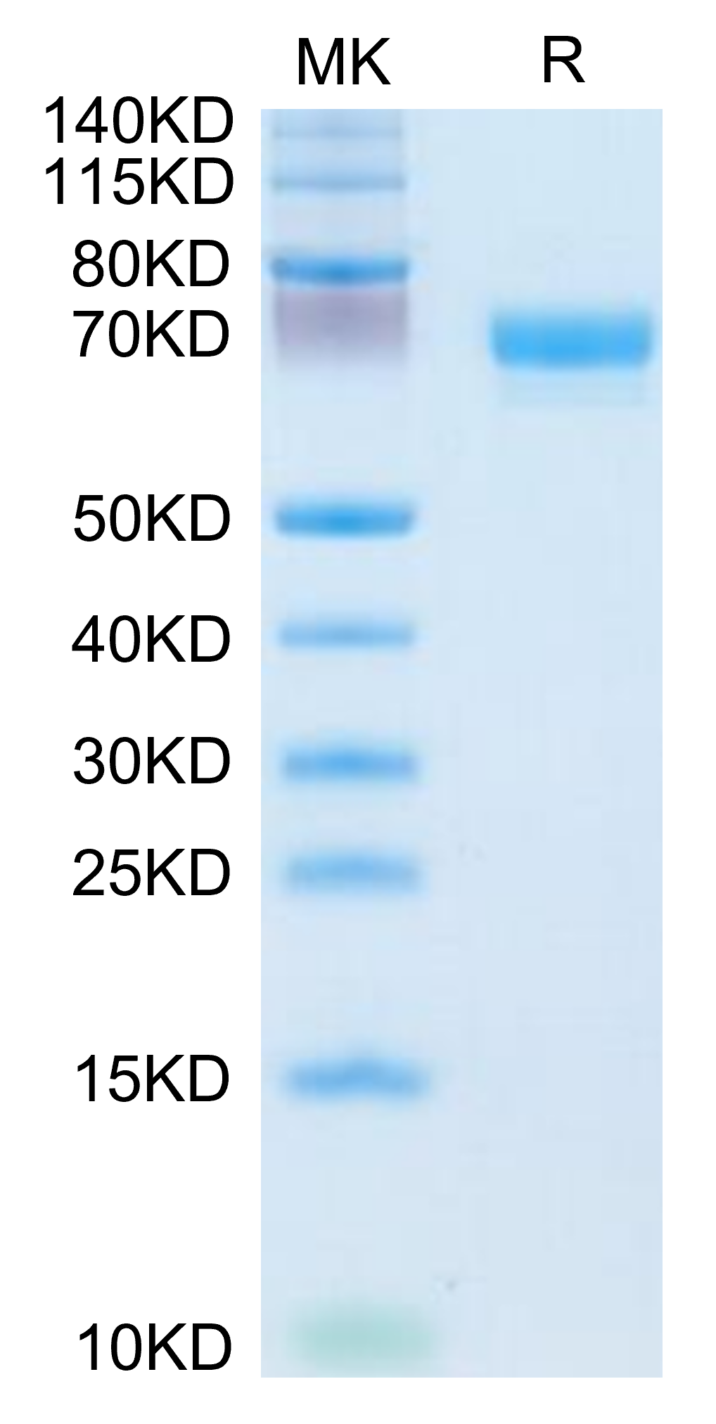 Human EPHA4 Protein, Ultra Low Endotoxin (EPH-HM104-UL) | KACTUS