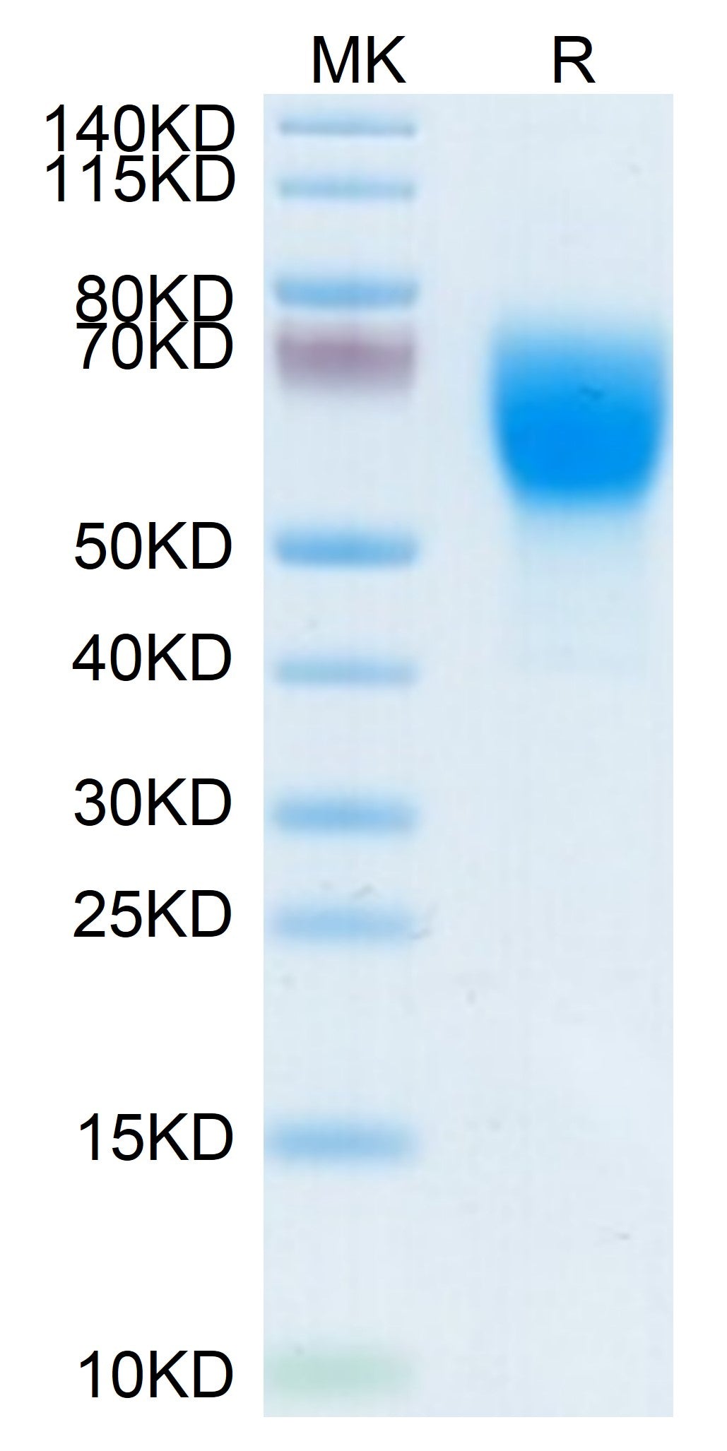 Mouse SELL/CD62L Protein, Ultra Low Endotoxin (SEL-MM10L-UL) | KACTUS
