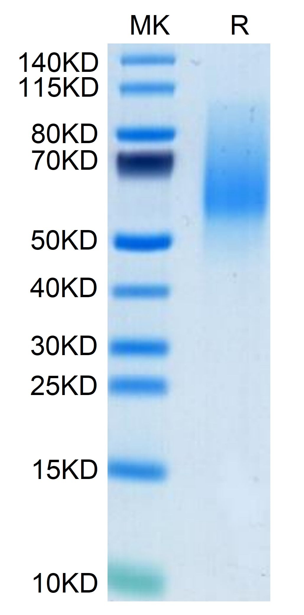 Mouse MANSC1 Protein, Ultra Low Endotoxin (MAN-MM1C1-UL) | KACTUS