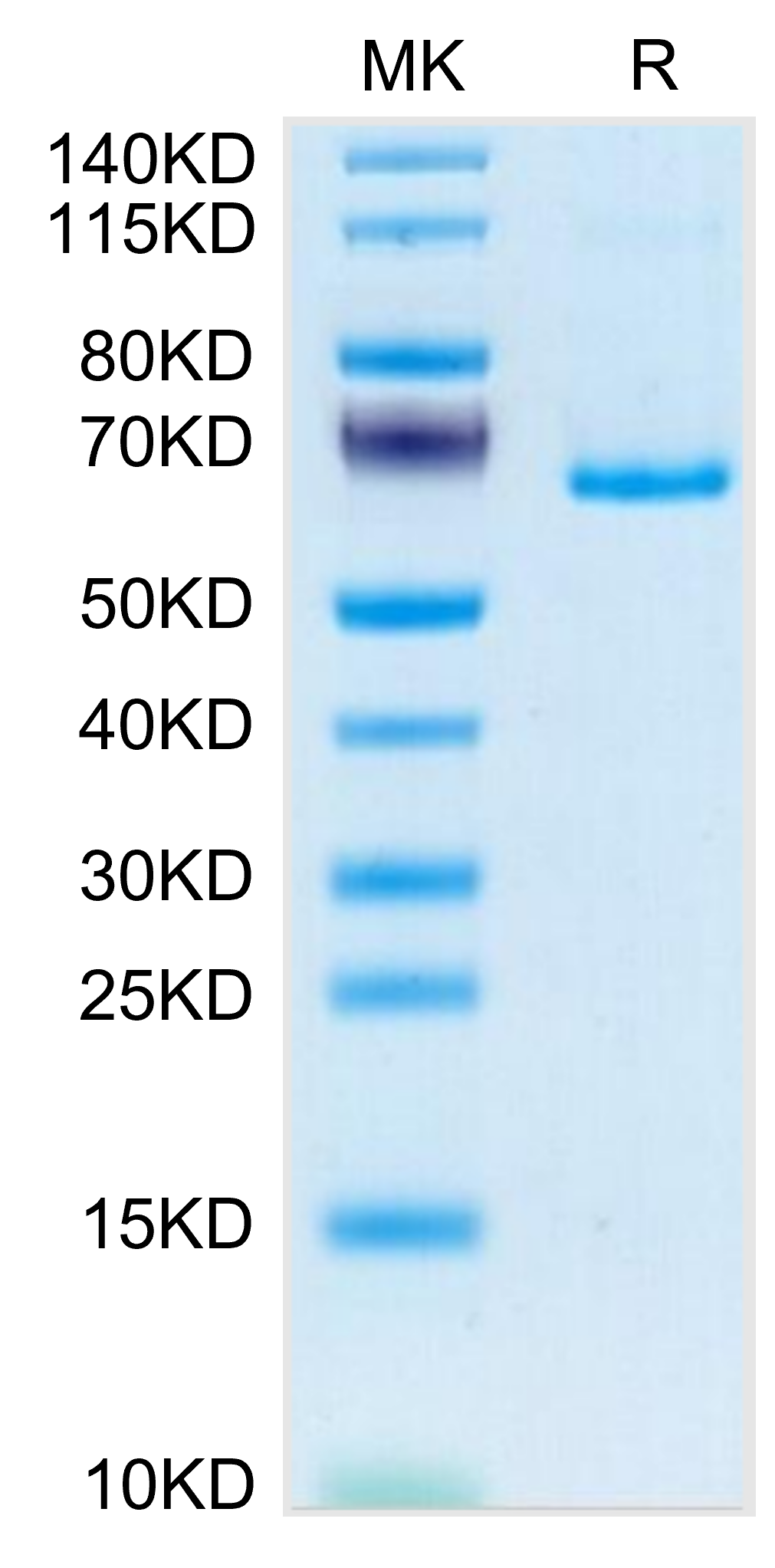 Mouse EphB3 Protein, Ultra Low Endotoxin (EPH-MM1B3-UL) | KACTUS