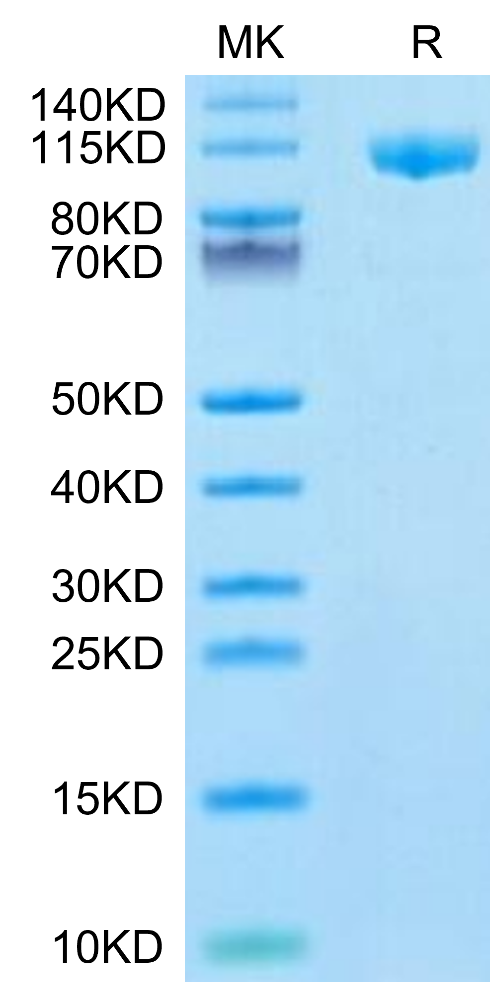 Mouse Siglec-2/CD22 Protein, Ultra Low Endotoxin (SIG-MM122-UL) | KACTUS