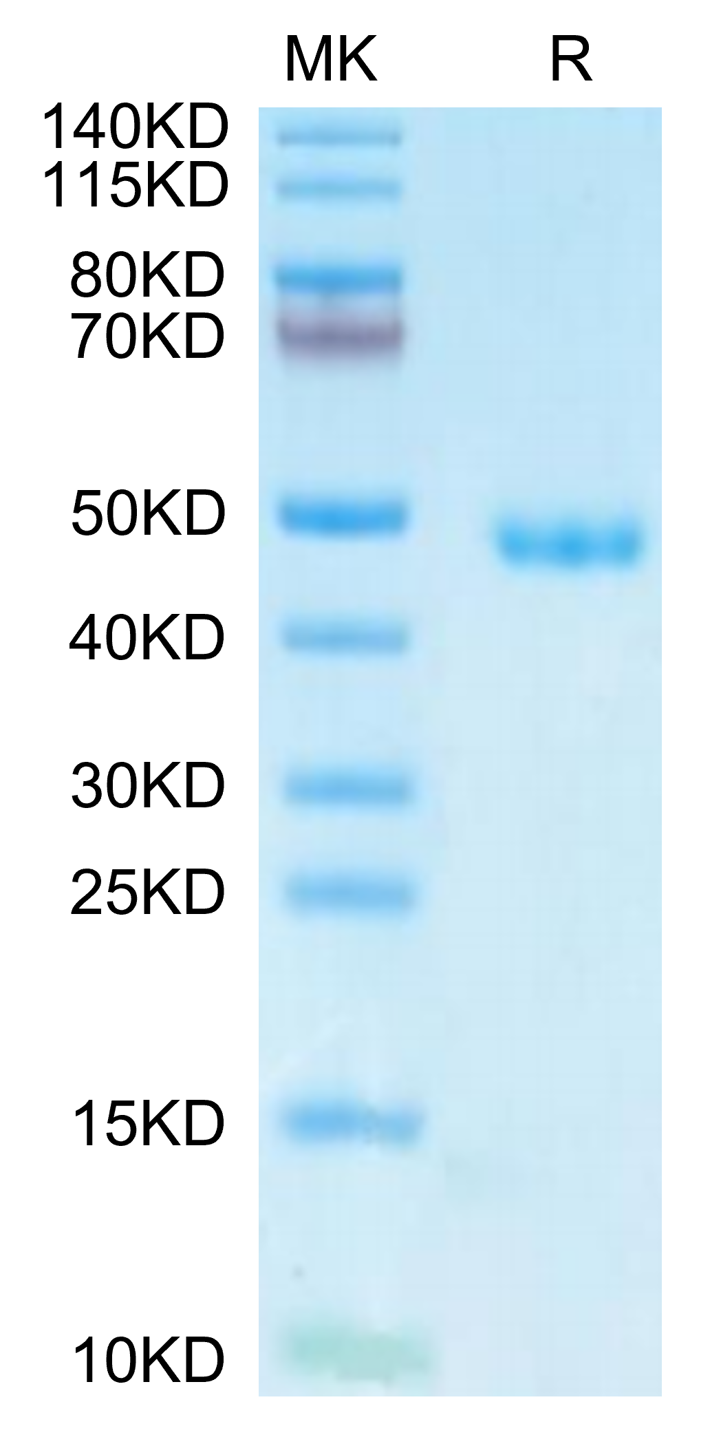 Mouse AGER Protein, Ultra Low Endotoxin (RAG-MM10E-UL) | KACTUS