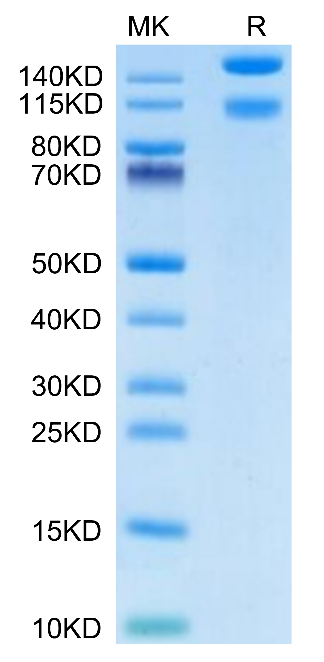 Mouse Integrin alpha 1 beta 1 (ITGA1&ITGB1) Heterodimer Protein, Ultra ...