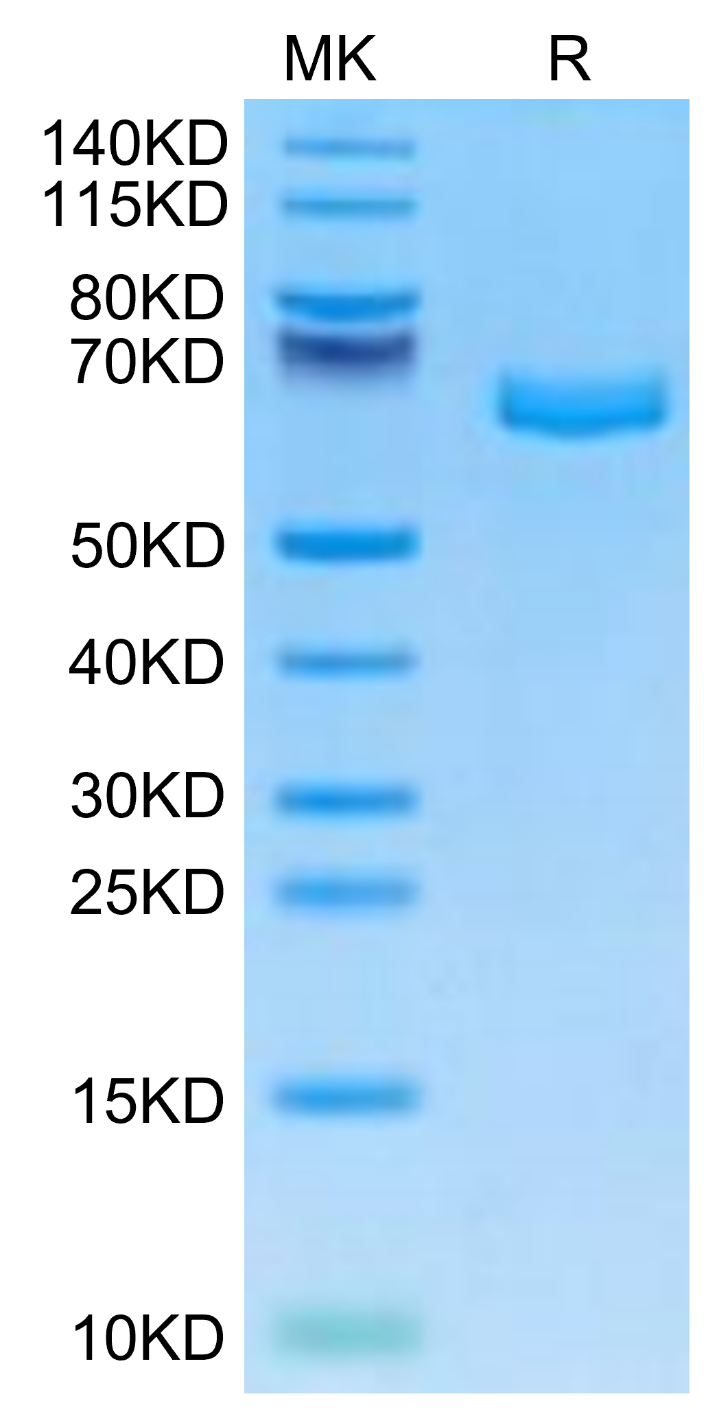 Mouse EPHA2 Protein, Ultra Low Endotoxin (EPH-MM1A2-UL) | KACTUS
