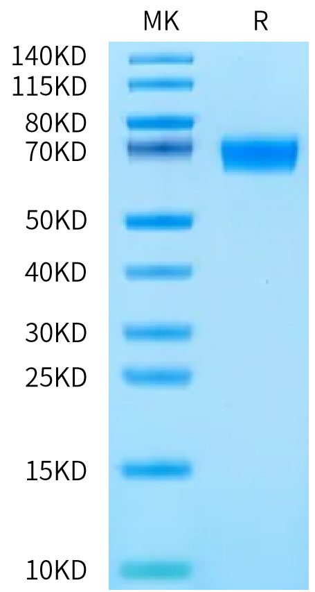 Mouse Musk (muscle, skeletal receptor tyrosine-protein kinase) Protein ...