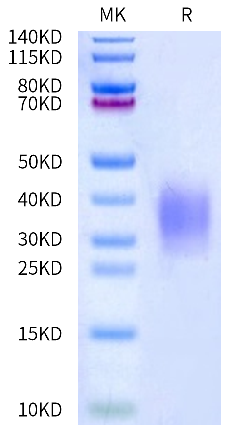 Biotinylated Mouse uPAR/PLAUR Domain 3 Protein (PAR-MM1D3B) | KACTUS