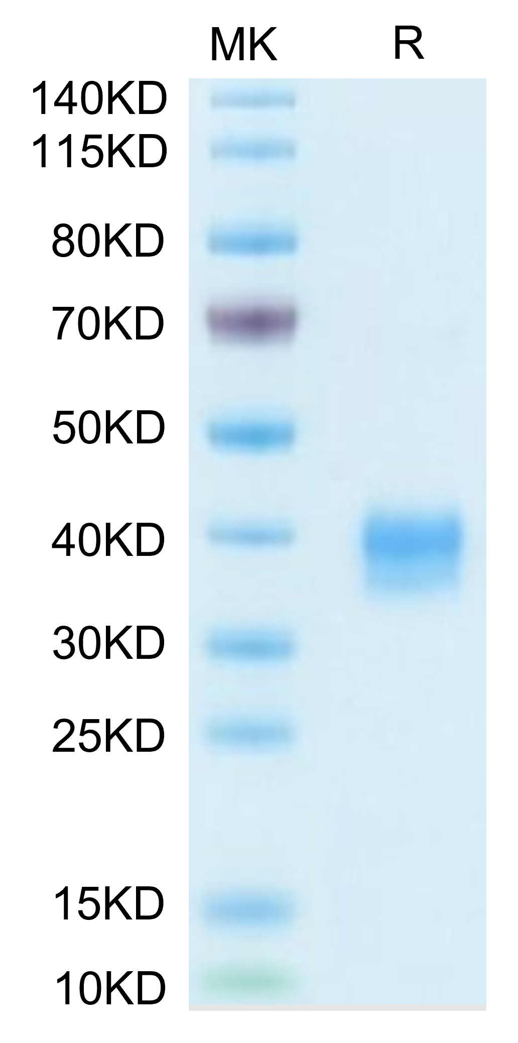 Biotinylated Mouse Siglec-15/CD33L3 Protein (Primary Amine Labeling ...