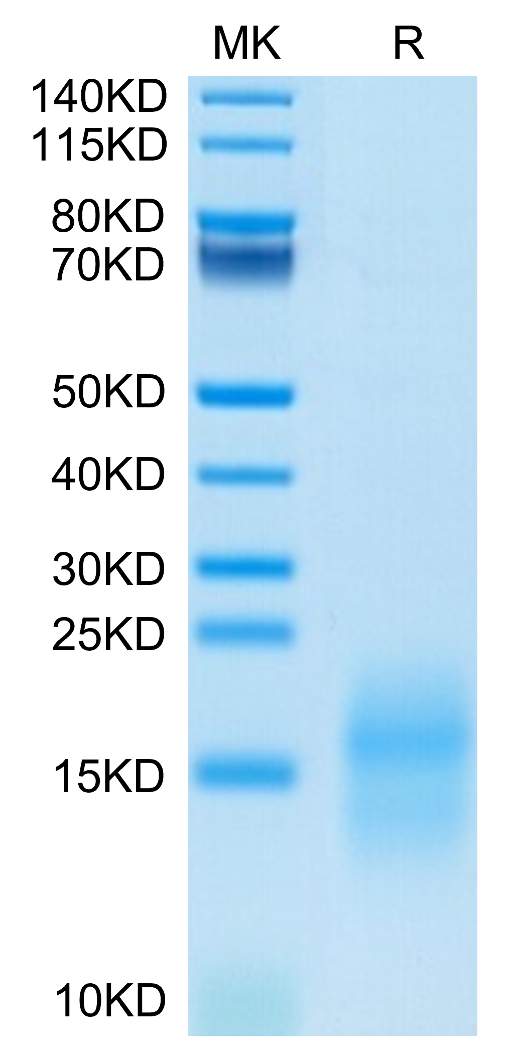 Mouse GIP Protein (GIP-MM101) | KACTUS