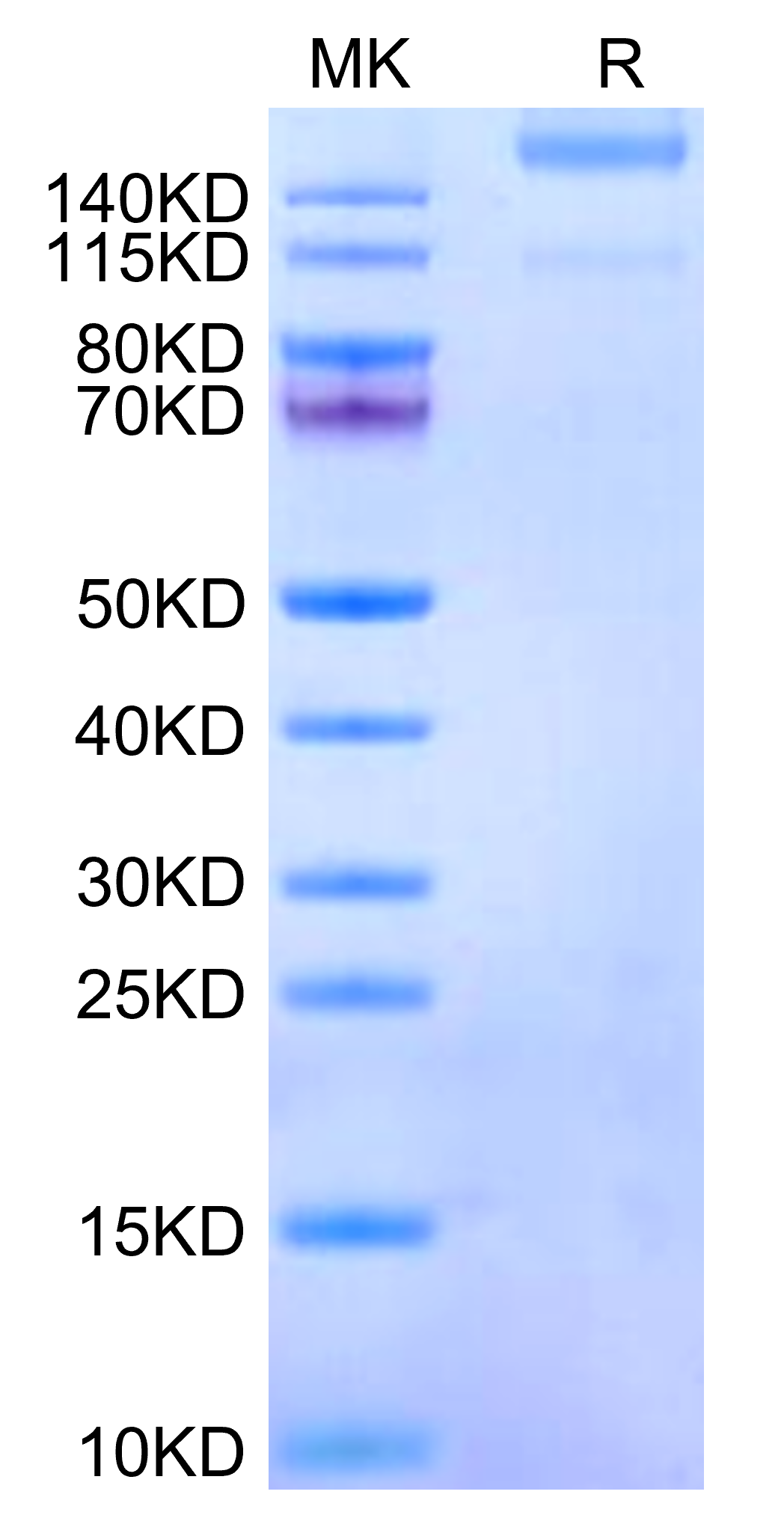 Human Integrin alpha 1 beta 1 (ITGA1&ITGB1) Heterodimer Protein (ITG ...